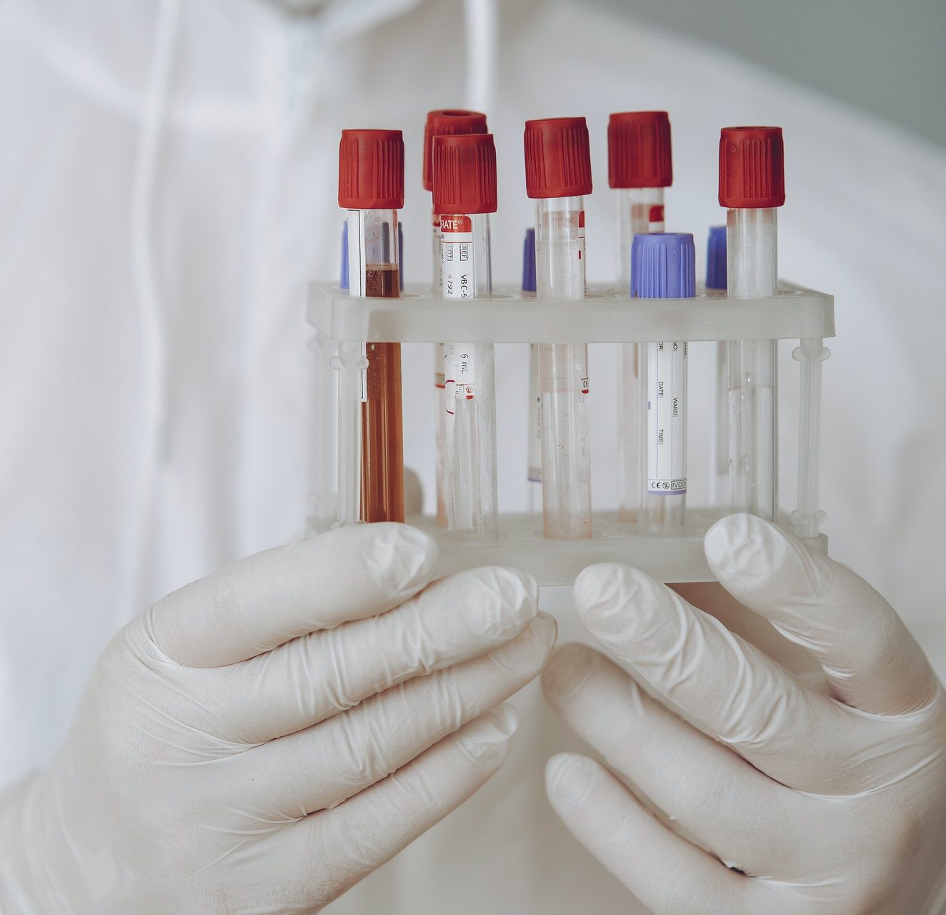 Your Trusted Medical Laboratory in Wayne NJ | Novalab Corp