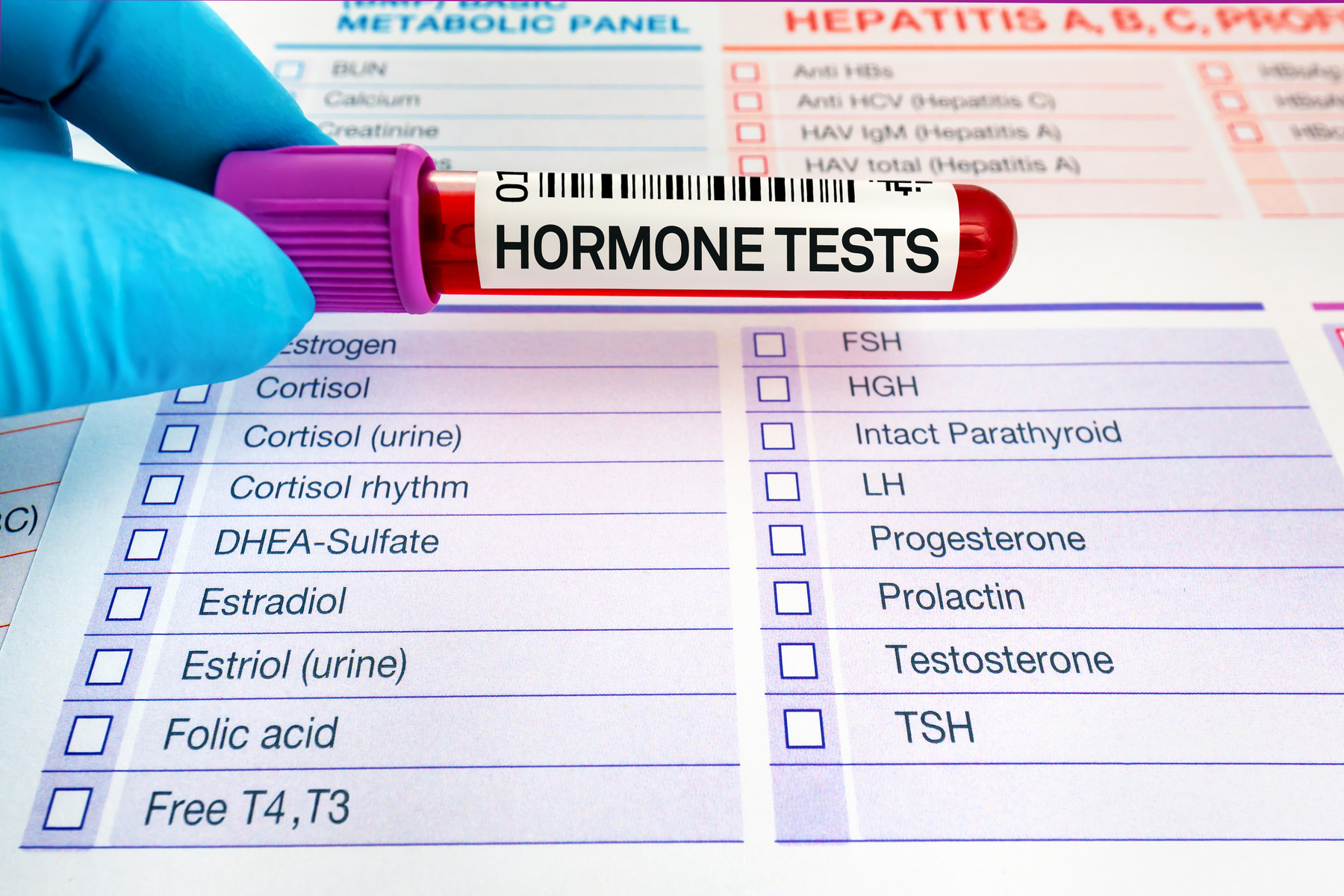 Hormone pellets lab tests | NovaLab Corp